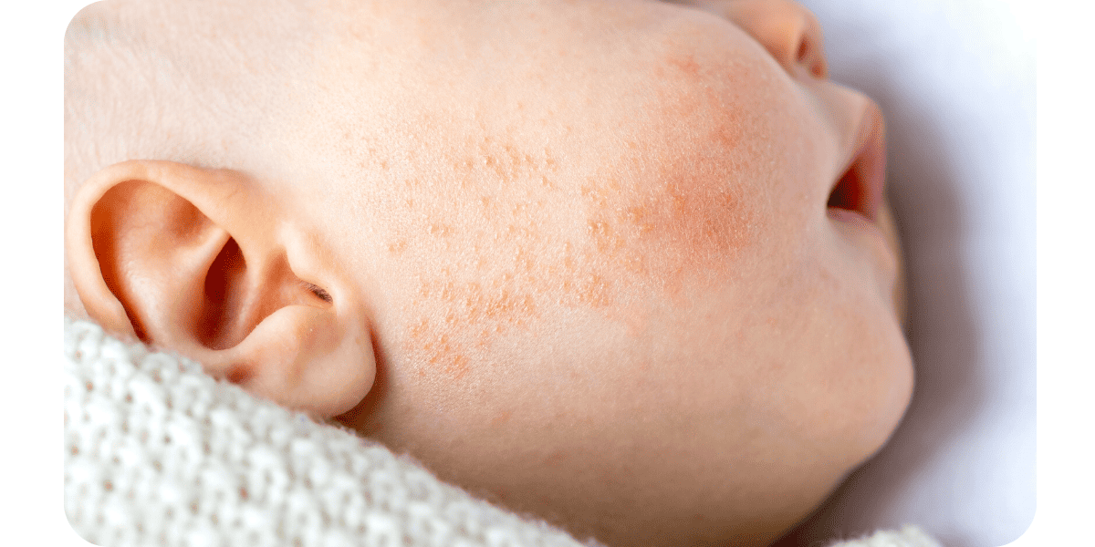 Why Does my Baby's Face Turn Red When Breastfeeding? 12 reasons