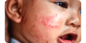 Why Does my Baby's Face Turn Red When Breastfeeding? 12 reasons